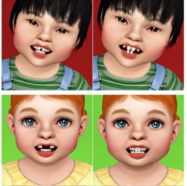 Mod The Sims - WCIF moonskin1993 Child Teeth