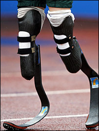 Mod The Sims - Amputee and prosthetic limbs custom content?